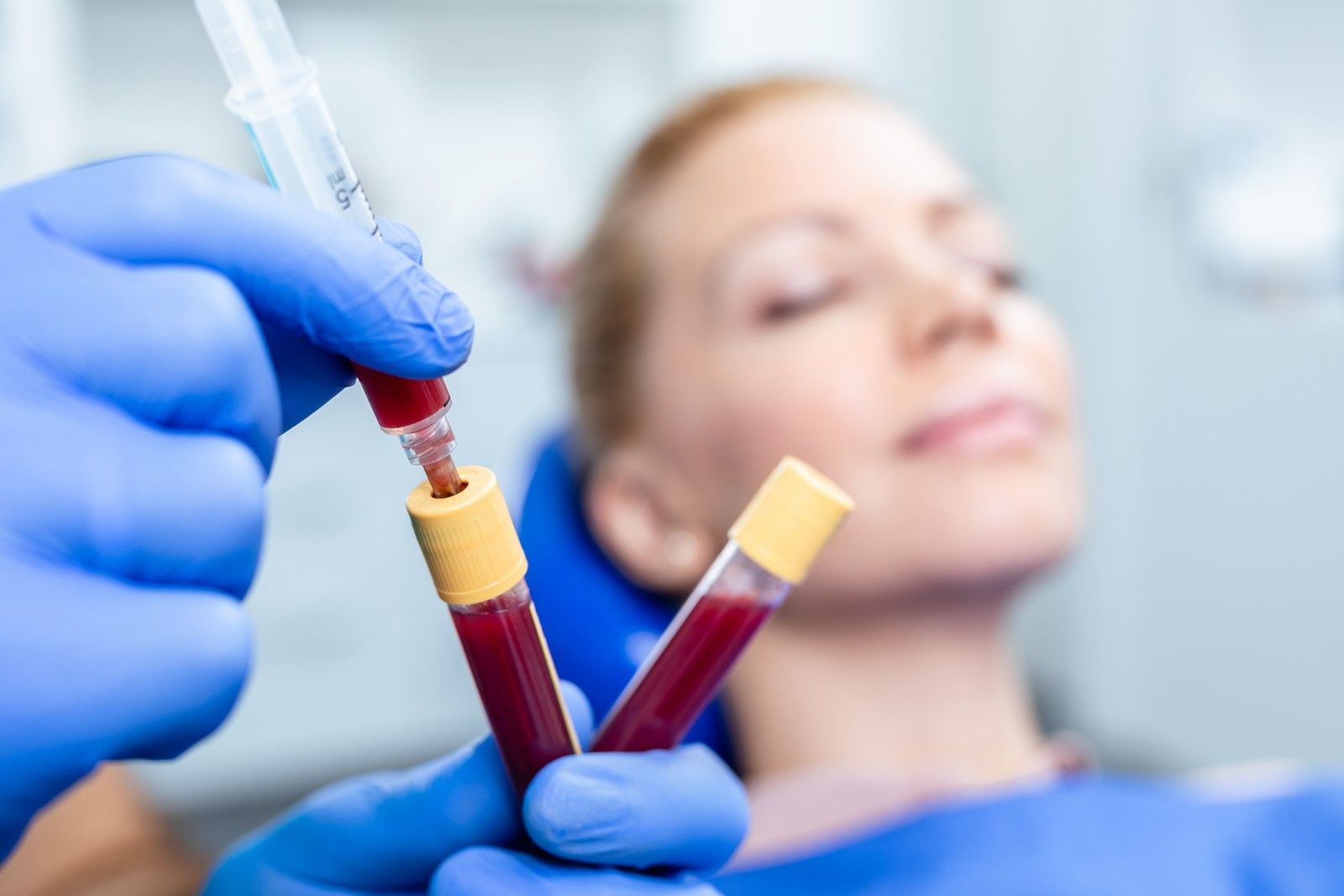 PRP therapy — Lohuis Filipović Medical Group