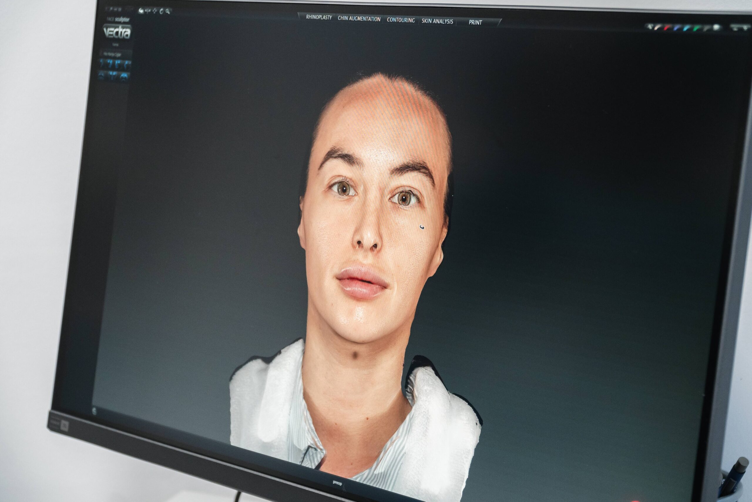 Halo Surgery: Innovation in Aesthetic Medicine — Lohuis Filipović ...